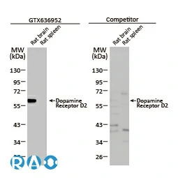 G蛋白偶联受体 (GPCRs) | GeneTex中文官方网站