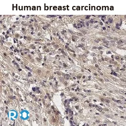 G蛋白偶联受体 (GPCRs) | GeneTex中文官方网站