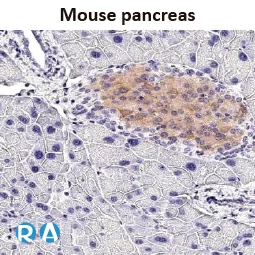 G蛋白偶联受体 (GPCRs) | GeneTex中文官方网站