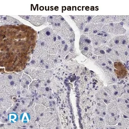 G蛋白偶联受体 (GPCRs) | GeneTex中文官方网站