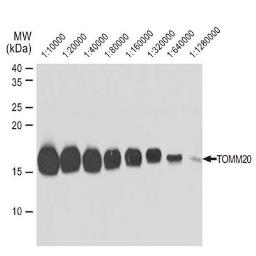 TOMM20抗体 [GT1136] (GTX00773) | GeneTex中国官方网站