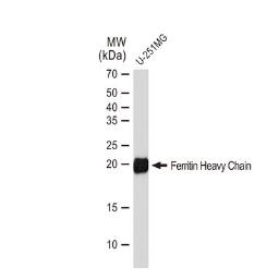 Ferritin Heavy Chain抗体 [GT1149] (GTX00928) | GeneTex中国官方网站