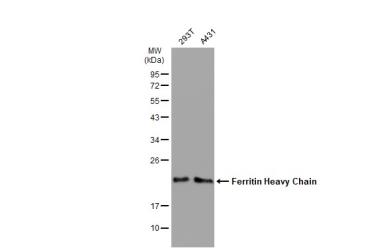 Ferritin Heavy Chain抗体 [GT1149] (GTX00928) | GeneTex中国官方网站