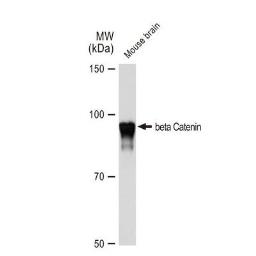 beta Catenin抗体 [GT1186] (GTX00948) | GeneTex中国官方网站