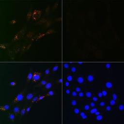 LC3B抗体 [GT1187] (GTX00949) | GeneTex中国官方网站