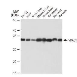 VDAC1抗体 [GT1235] (GTX01543) | GeneTex中国官方网站