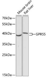 GPR55抗体 (GTX03363) | GeneTex中国官方网站