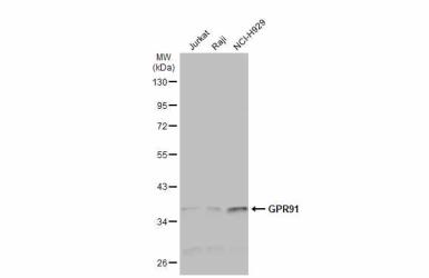 GPR91抗体 [N2N3] (GTX100170) | GeneTex中国官方网站