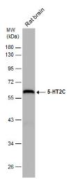 5-HT2C receptor抗体 (GTX100329) | GeneTex中国官方网站