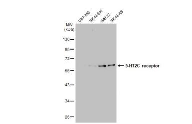 5-HT2C receptor抗体 (GTX100329) | GeneTex中国官方网站