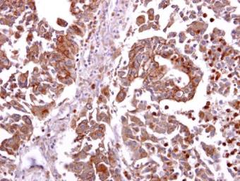 CCR8抗体 (GTX100343) | GeneTex中国官方网站