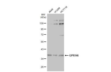 GPR146抗体 [C1C2], Internal (GTX100365) | GeneTex中国官方网站