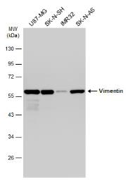 Vimentin抗体 (GTX100619) | GeneTex中国官方网站