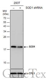 SOD1抗体 (GTX100659) | GeneTex中国官方网站