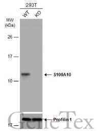 S100A10抗体 (GTX100697) | GeneTex中国官方网站