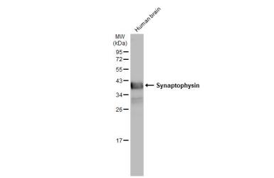 Synaptophysin抗体 (GTX100865) | GeneTex中国官方网站