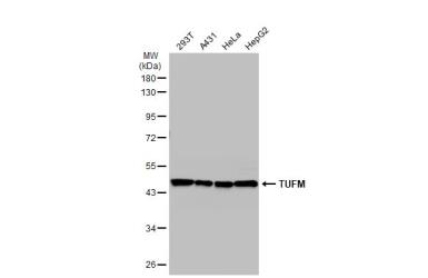 TUFM抗体 (GTX101763) | GeneTex中国官方网站