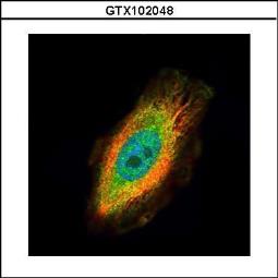 TRIM27抗体 (GTX102048) | GeneTex中国官方网站