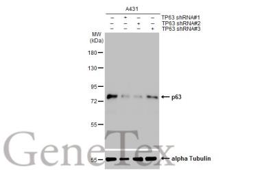 p63抗体 [N2C1], Internal (GTX102425) | GeneTex中国官方网站