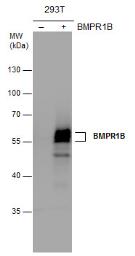 BMPR1B抗体 [N3C3] (GTX102453) | GeneTex中国官方网站