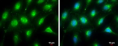 LAMP2抗体 (GTX103214) | GeneTex中国官方网站