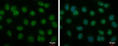 BMAL1抗体 [N1N3] (GTX105060) | GeneTex中国官方网站