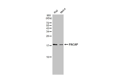 PACAP抗体 [N1C3] (GTX106794) | GeneTex中文官方网站