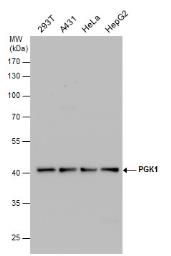 PGK1抗体 (GTX107614) | GeneTex中国官方网站