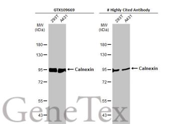 Calnexin抗体 [C3], C-term (GTX109669) | GeneTex中国官方网站