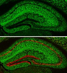 MAP2抗体 [HM-2] (GTX11267) | GeneTex中国官方网站
