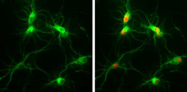 MAP2抗体 [HM-2] (GTX11267) | GeneTex中国官方网站