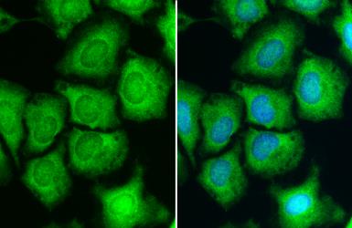 RPS6抗体 (GTX113542) | GeneTex中国官方网站