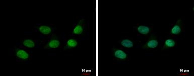 HP1 alpha抗体 (GTX113944) | GeneTex中国官方网站