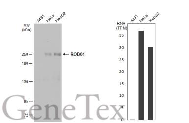 ROBO1抗体 (GTX114103) | GeneTex中国官方网站