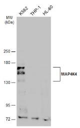 MAP4K4抗体 (GTX116008) | GeneTex中国官方网站