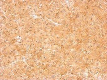 Loricrin抗体 [N1], N-term (GTX116013) | GeneTex中国官方网站