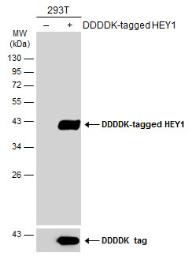 HEY1抗体 (GTX118007) | GeneTex中国官方网站