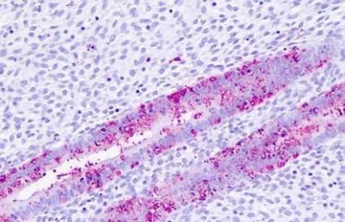 TGR5抗体 (GTX12523) | GeneTex中国官方网站