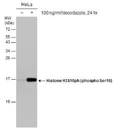 Histone H3S10ph (phospho Ser10)抗体 (GTX128116) | GeneTex中国官方网站