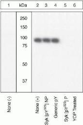 Syk (phospho Tyr323)抗体 (GTX12862) | GeneTex中国官方网站