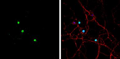 ASCL1抗体 (GTX129189) | GeneTex中国官方网站