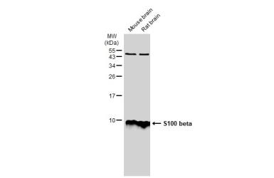 Anti-S100 beta antibody (GTX129573) | GeneTex