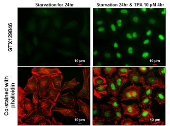 c-Fos抗体 (GTX129846) | GeneTex中国官方网站