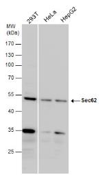 Sec62抗体 (GTX129853) | GeneTex中国官方网站