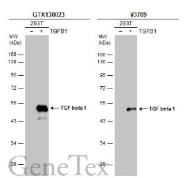TGF beta 1抗体 (GTX130023) | GeneTex中国官方网站