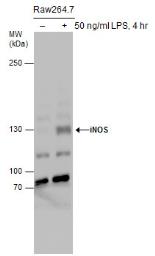 iNOS抗体 (GTX130182) | GeneTex中国官方网站