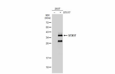STX17抗体 (GTX130212) | GeneTex中国官方网站