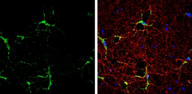 iNOS抗体 (GTX130246) | GeneTex中国官方网站