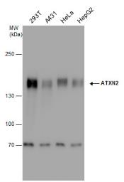 ATXN2抗体 (GTX130329) | GeneTex中国官方网站