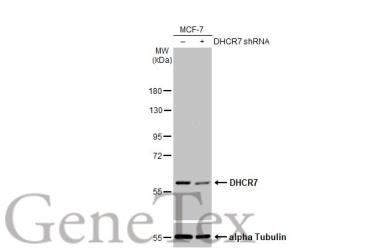 DHCR7抗体 (GTX130695) | GeneTex中国官方网站